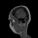 Caput, an Interactive 3D Anatomical Atlas of the Head and Neck Region ...